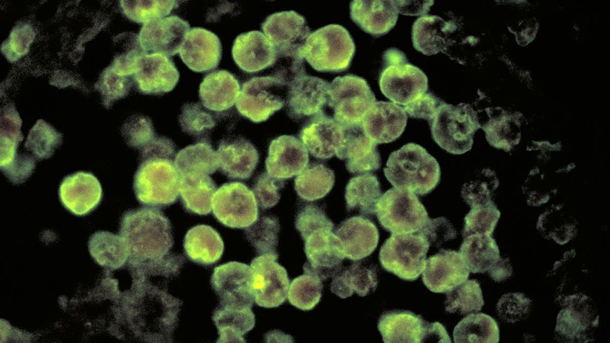 'Brain-eating' amoebas kill nearly 100% of victims. Could new ...
