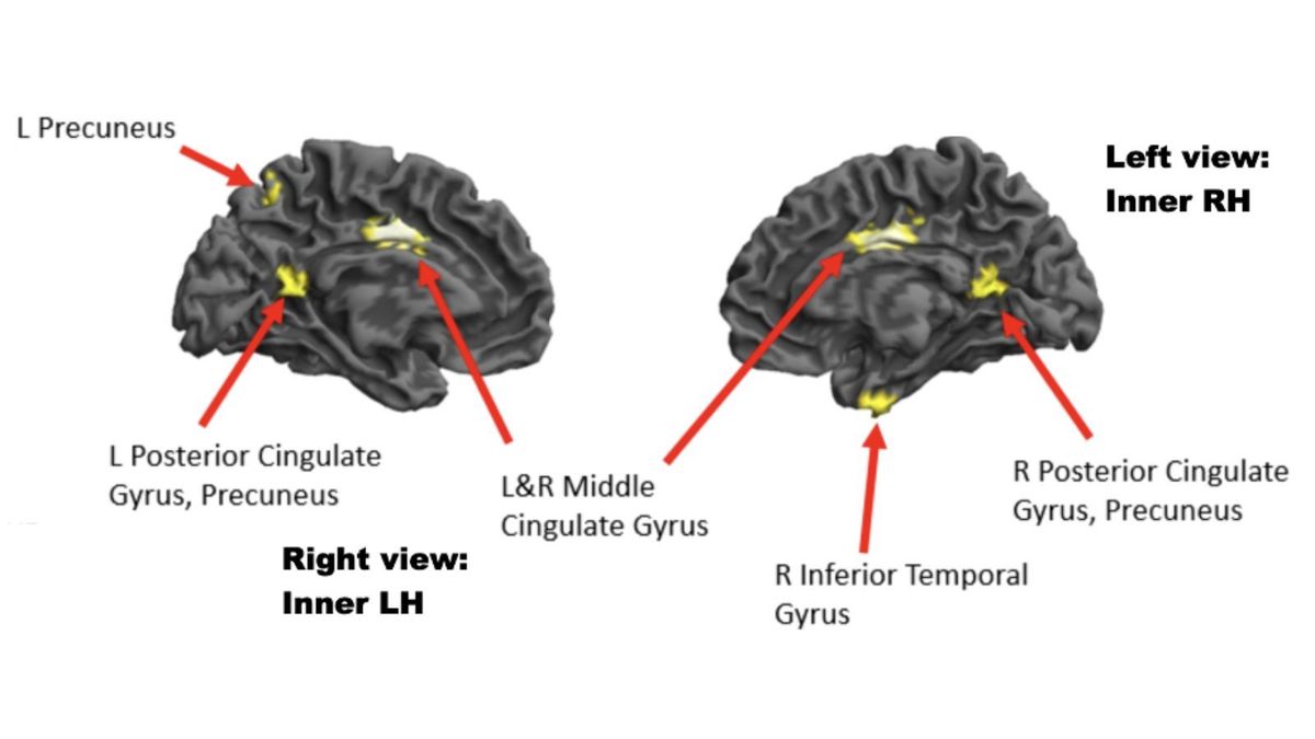 'Flow state' uncovered: We finally know what happens in the brain when ...