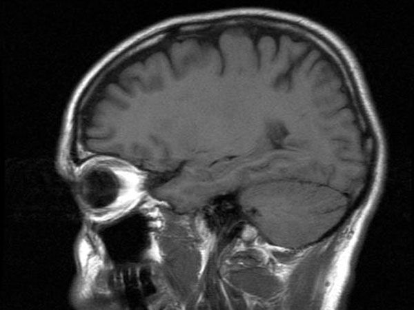Do We Really Only Use 10 Percent of Our Brains? | Live Science Do We Really Only Use 10 Percent of Our Brains? | Live Science
