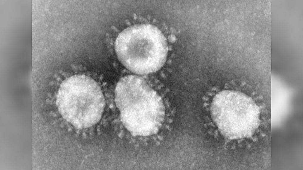 The deadliest viruses in history | Live Science