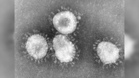 The deadliest viruses in history | Live Science