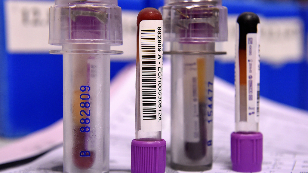 What is doping? And which performance-enhancing drugs are banned ...