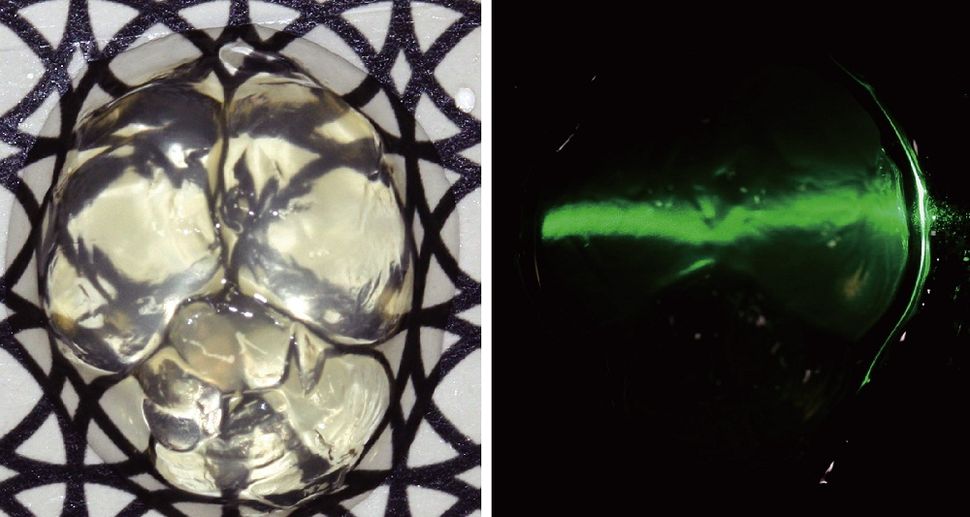 See-Through Brain Reveals How Cells Connect | Live Science