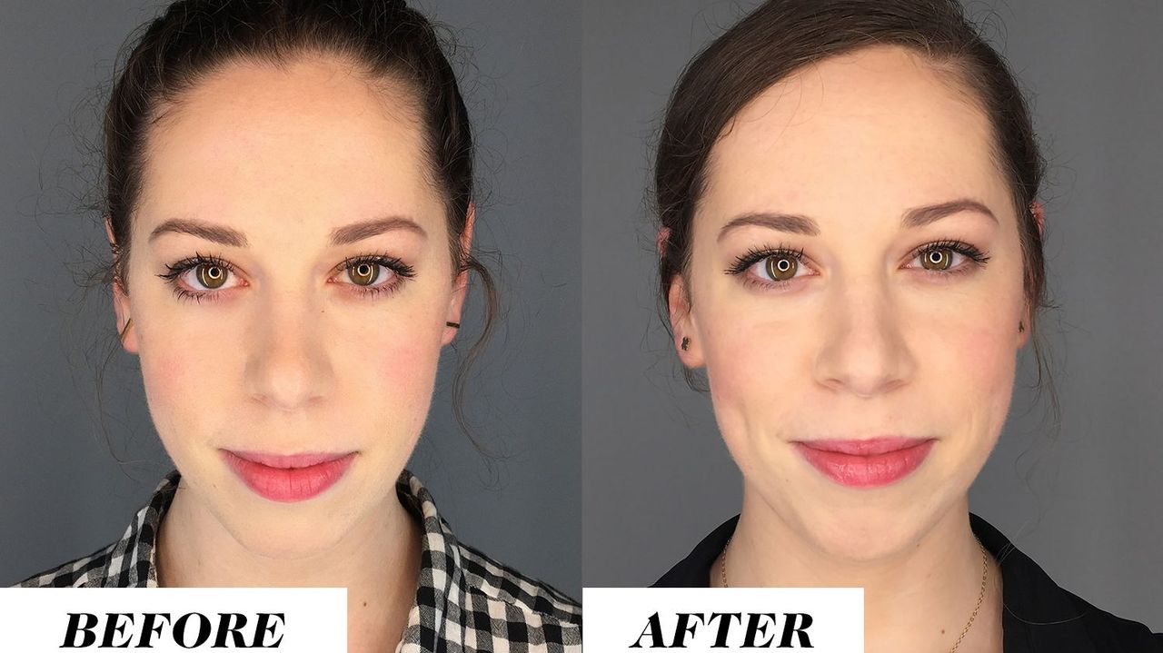 Does Drinking Water Help Your Skin - Facts on Drinking Water for Acne ...