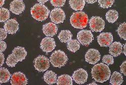 Bionic Humans: Top 10 Technologies | Live Science