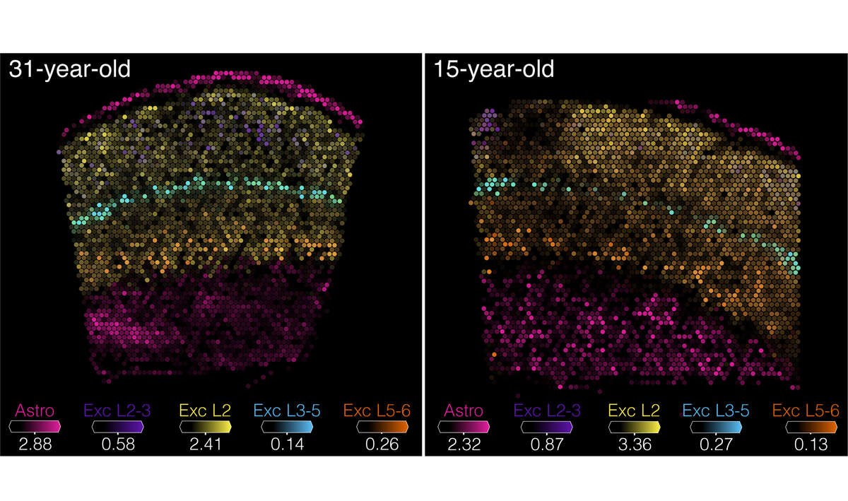 Scientists take huge step forward in making atlas of all 37 trillion ...