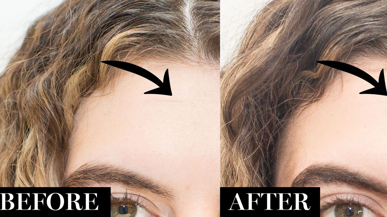 Botox Alternative Cream - How to Get Rid of a Wrinkle | Marie Claire