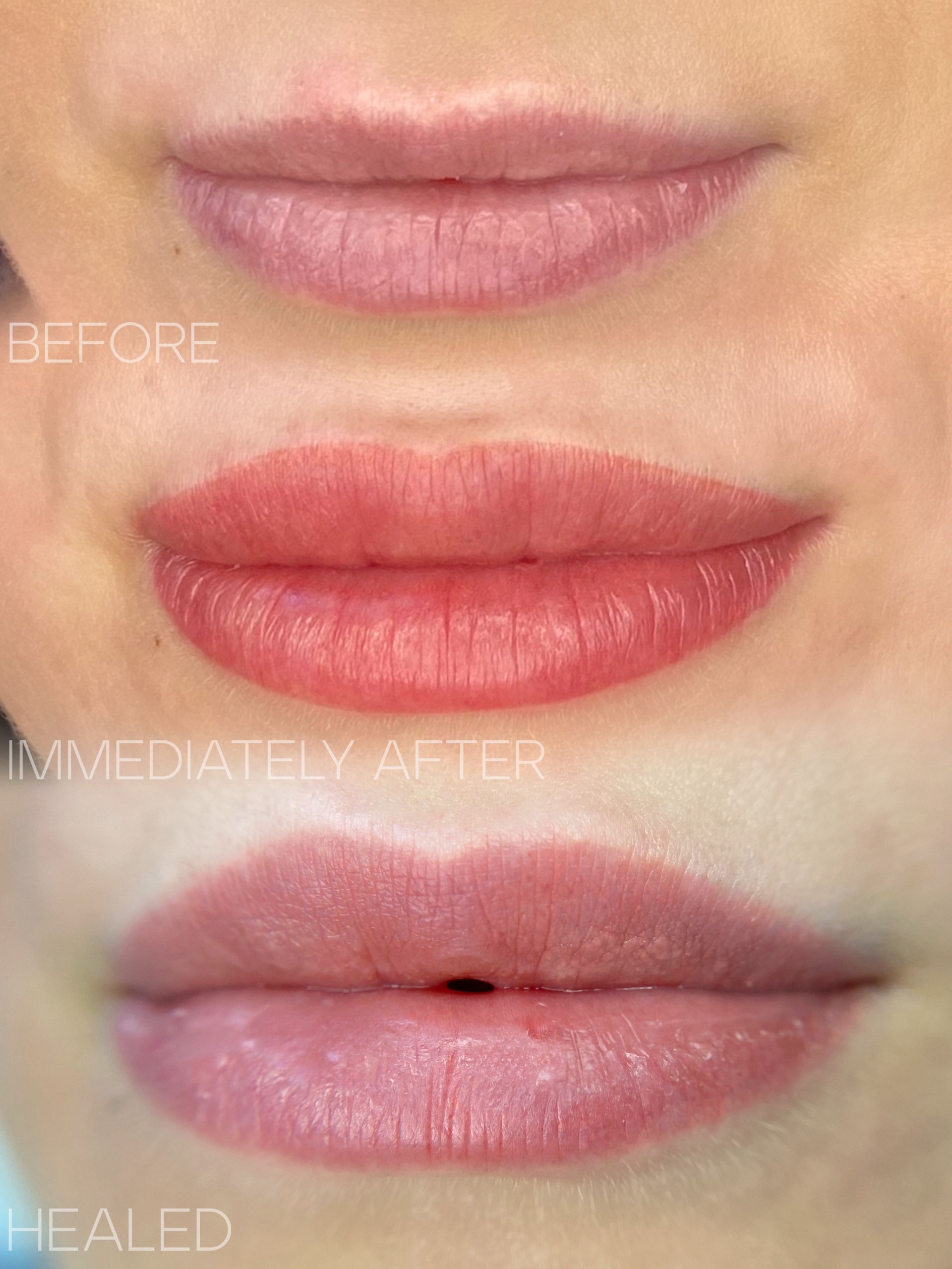 What Is Lip Blushing: My Results, Before/After Photos, Process | Marie ...