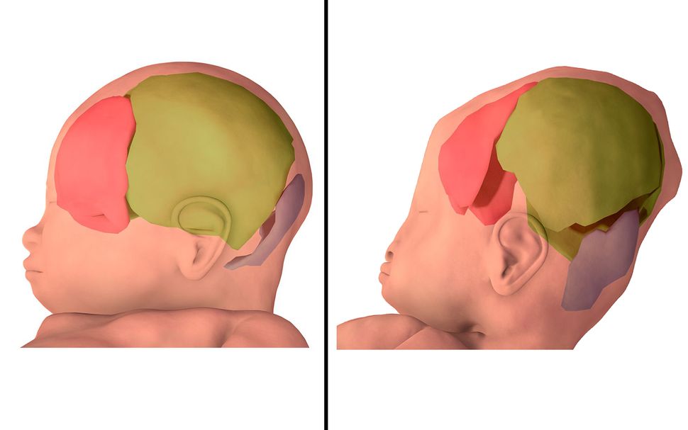 How Much Do Babies’ Skulls Get Squished During Birth? A Whole Lot, 3D ...
