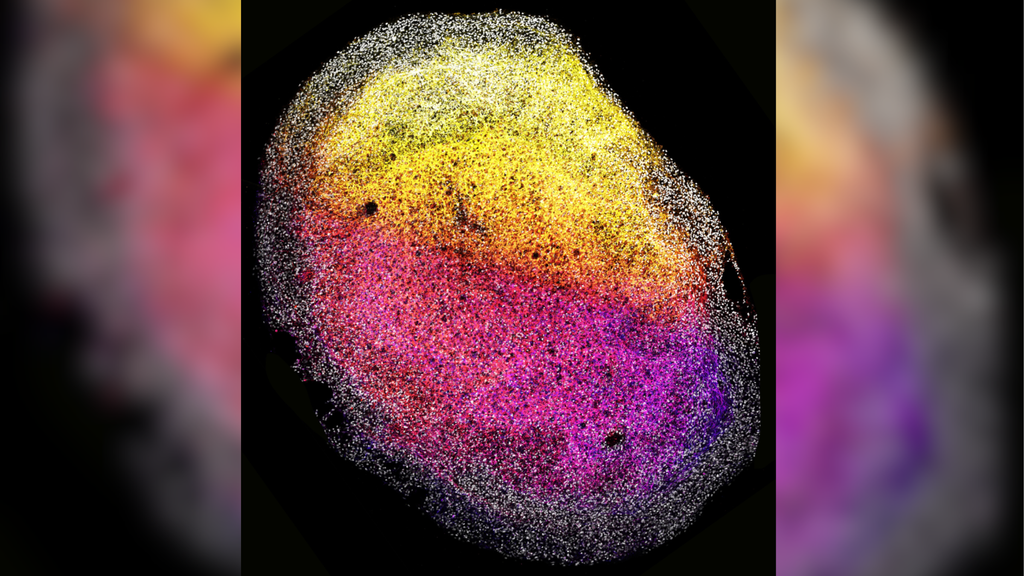 Body parts grown in the lab | Live Science