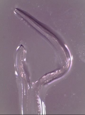 Weird Worm Crawling in Oregon Woman's Eye Has Only Been Seen in Cows ...
