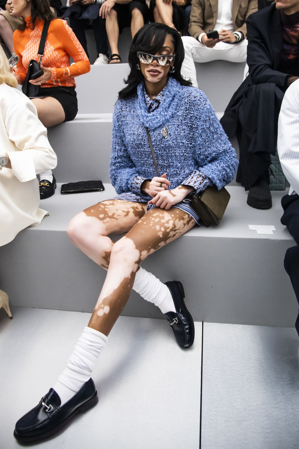 How to Even Skin Tone on Legs: Causes and Treatments | Marie Claire