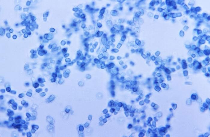 Valley Fever Fungus Invades the Brain in 3 Rare Cases | Live Science