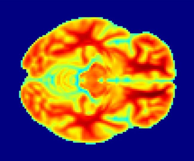 How a Map of Your Brain Can Trick Your Brain | Live Science