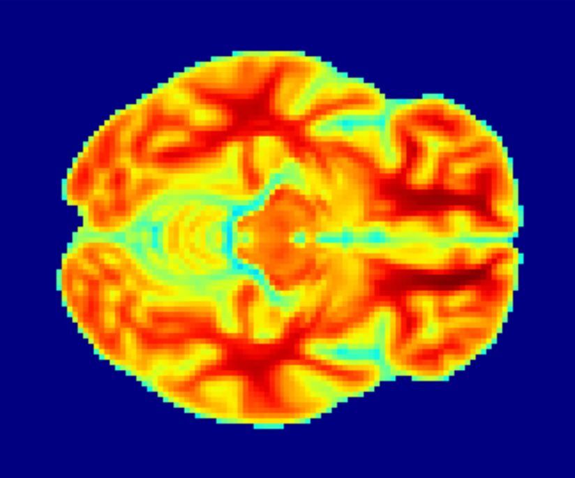 How a Map of Your Brain Can Trick Your Brain | Live Science