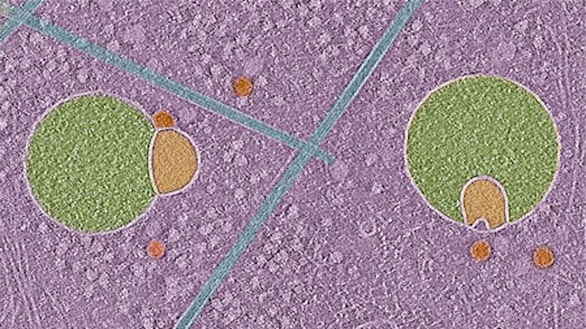 Tonsils: Definition, anatomy & function | Live Science