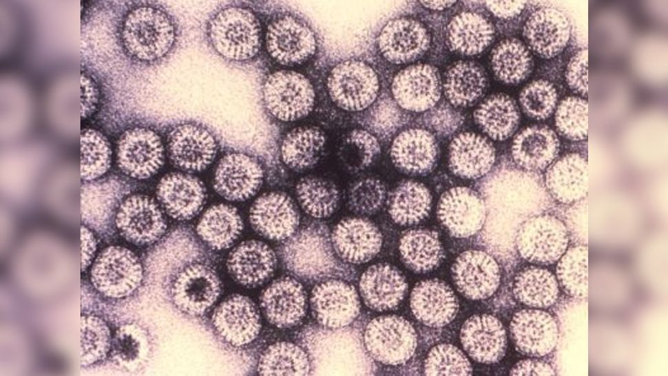 The deadliest viruses in history | Live Science
