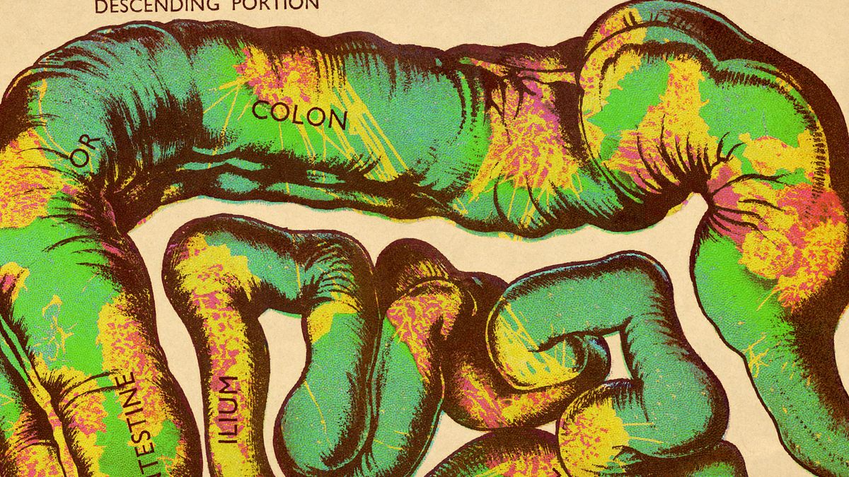 Colobactin may be contributing to rising colorectal cancer in younger ...