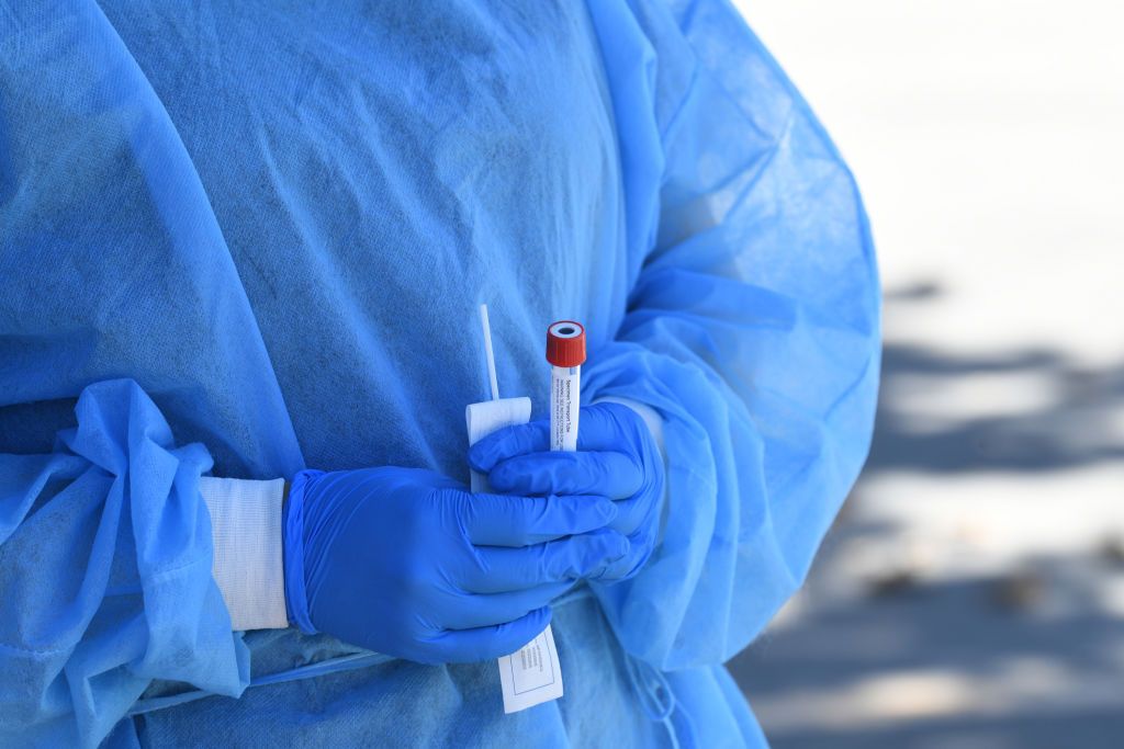 FDA approves startup's portable coronavirus test kit | The Week