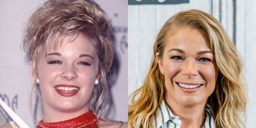 Celebrity Smiles Before and Afters - Celebrity Dental Work | Marie Claire
