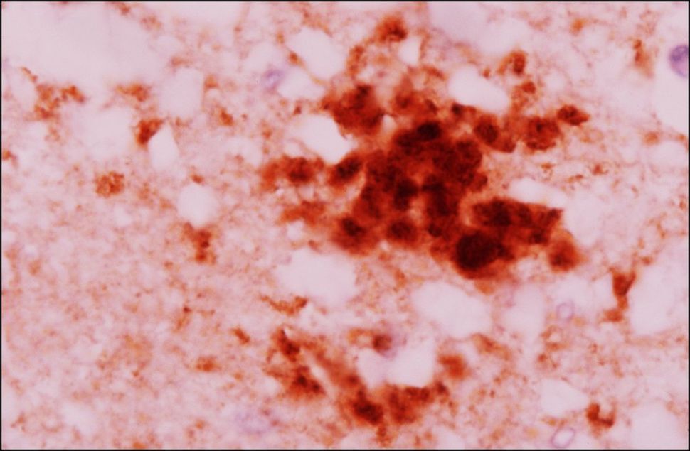 Here's How Dangerous, Deadly Prions Spread to the Brain | Live Science