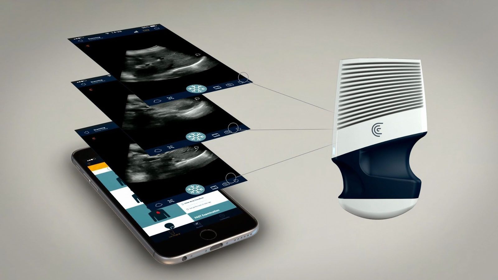 This portable ultrasound will beam images straight to your phone ...