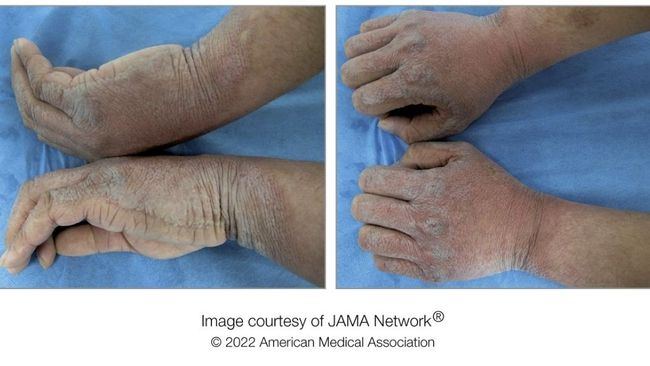 10 bizarre medical case reports | Live Science