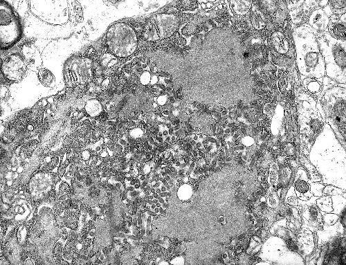 The 12 deadliest viruses on Earth | Live Science