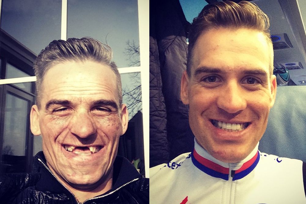 Zdenek Stybar back to his best after Flanders dental failure | Cycling ...