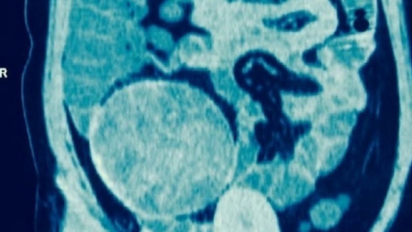 Pancreas: Function, Location & Diseases | Live Science