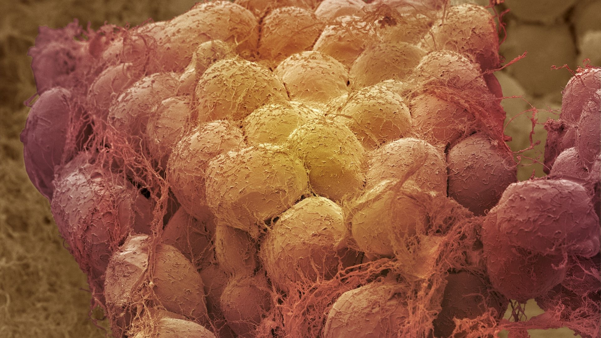 Weight loss may 'rejuvenate' fat tissues, clearing away aged cells ...