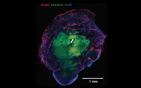 Tiny, Lab-Grown Minibrains Sprout Blood Vessels | Live Science