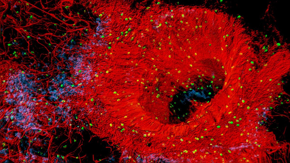 Life-saving research makes striking images in British Heart Foundation ...