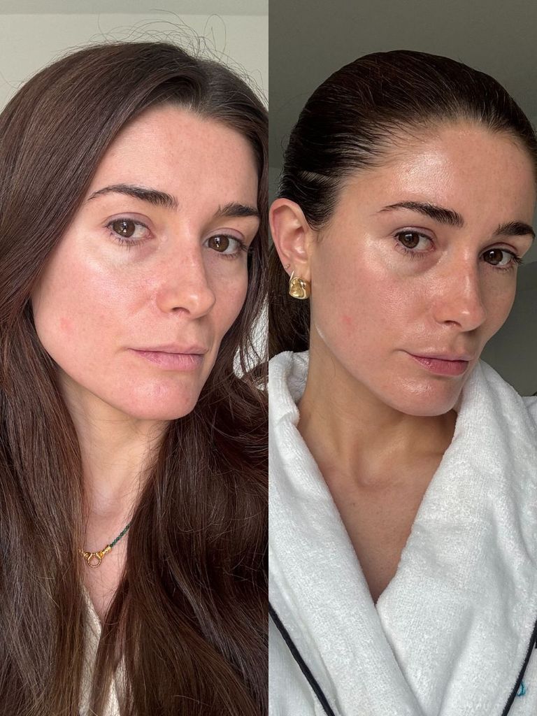 Shark CryoGlow LED Face Mask, Honestly Reviewed | Who What Wear