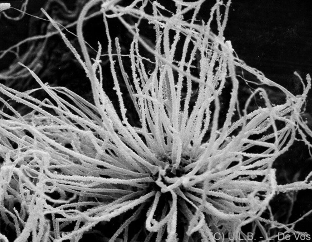 Microscopic Worlds Gallery: Fascinating Fungi | Live Science