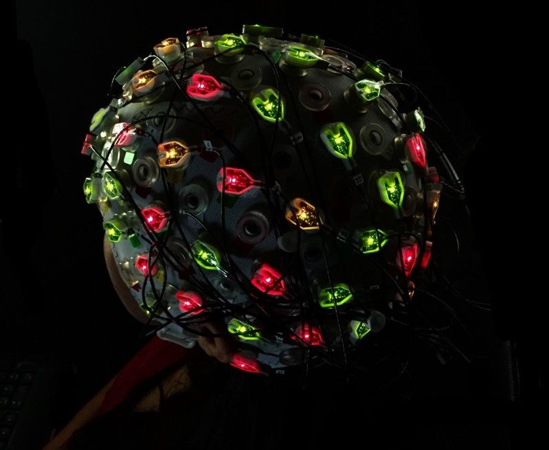 4 People with Locked-In Syndrome 'Talk' Using Their Minds | Live Science