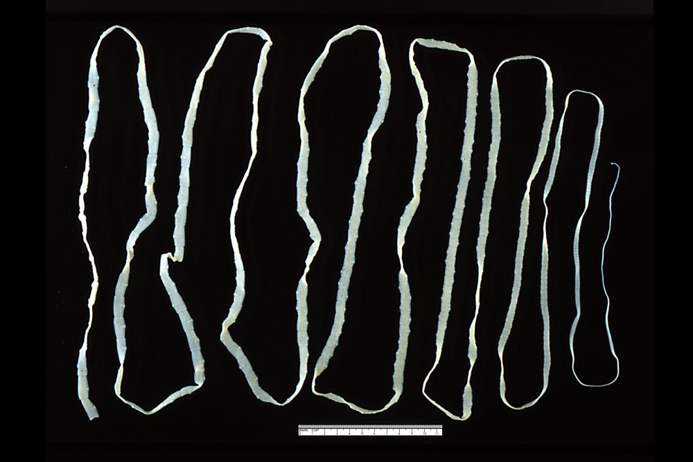 Tapeworms: Causes, Symptoms & Treatment | Live Science
