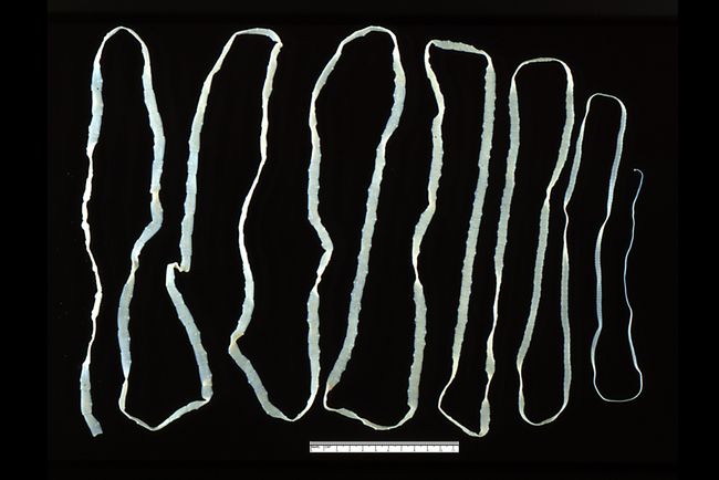 Tapeworms: Causes, Symptoms & Treatment | Live Science