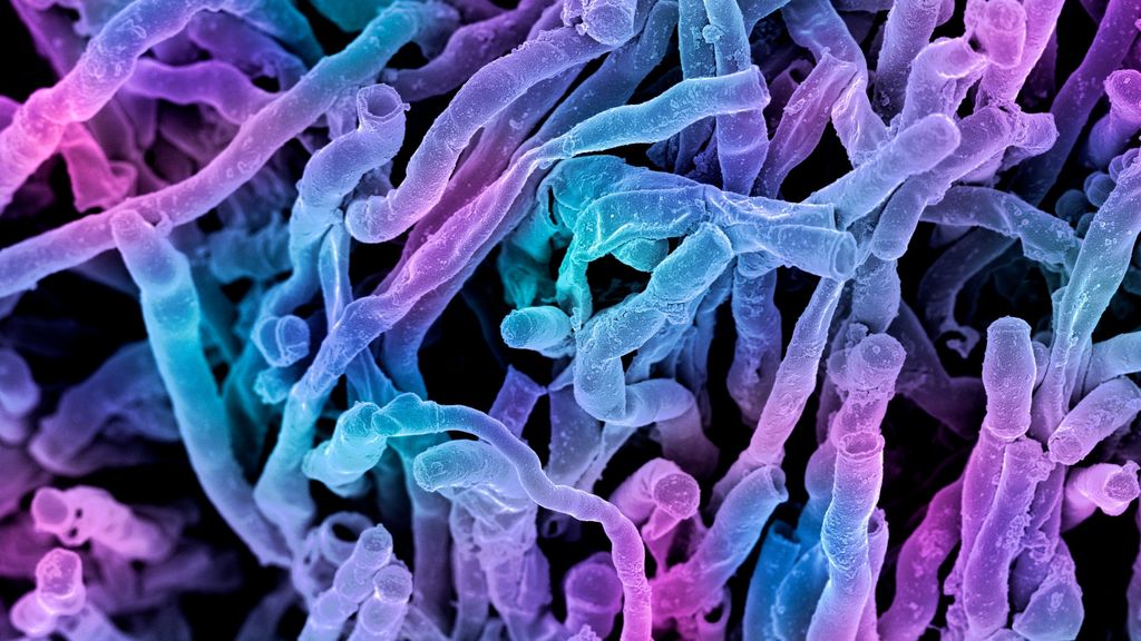 Arctic expedition uncovers deep-sea microbes that may harbor the next ...