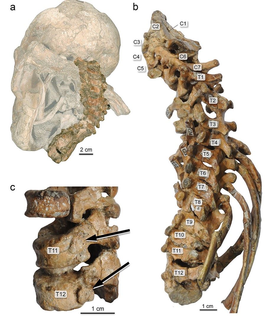 Image Gallery: 3-Year-Old Human Ancestor Revealed | Live Science