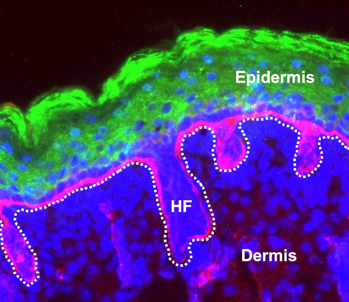 This gene-edited skin can detect its own glucose levels | The Week