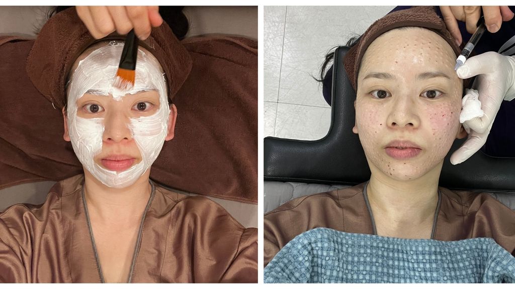 Review: I Got Salmon Sperm Injections In Korea for Glowing Skin | Marie ...
