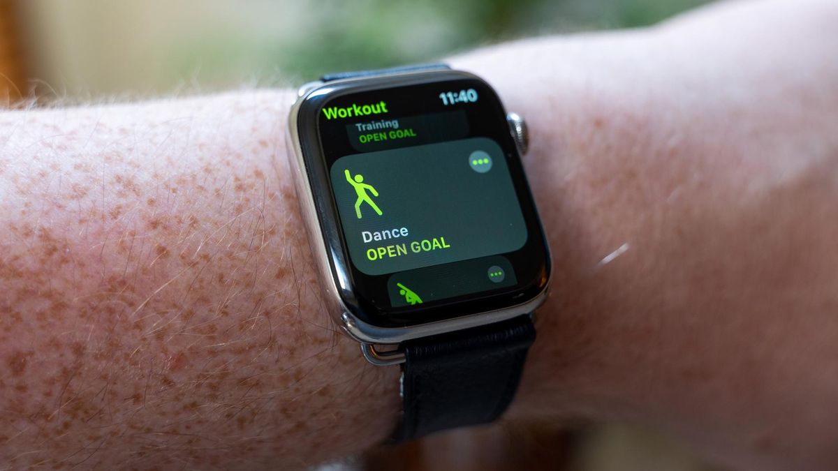 Which Apple Watch color should you get? | iMore