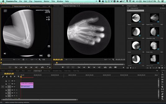 Animated X-rays reveal how your bones move | Creative Bloq