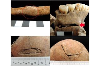 Medieval 'vampire' burial in Croatia contains decapitated and twisted ...