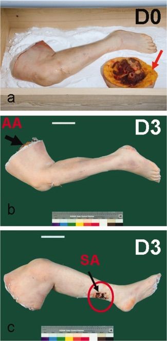Gallery: What Mummifying a Human Body Looks Like | Live Science