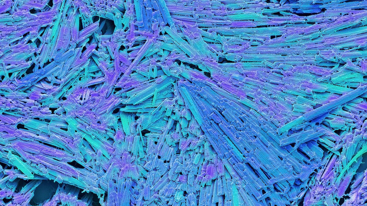 Lesch-Nyhan syndrome: The rare disease that causes people to move ...