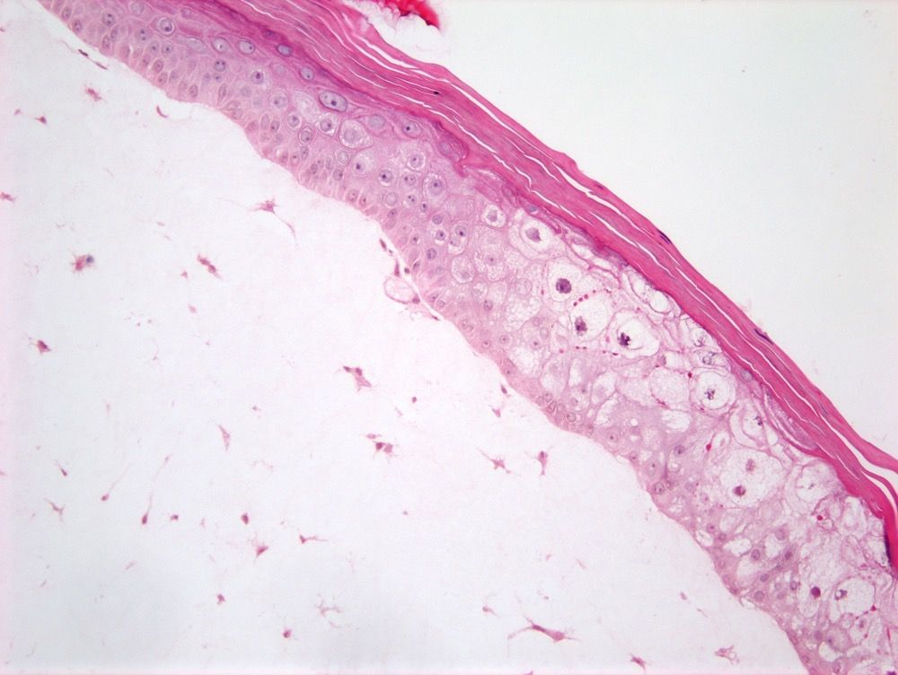 Why Scientists Are Growing Herpes-Ridden Turtle Skin in the Lab | Live ...