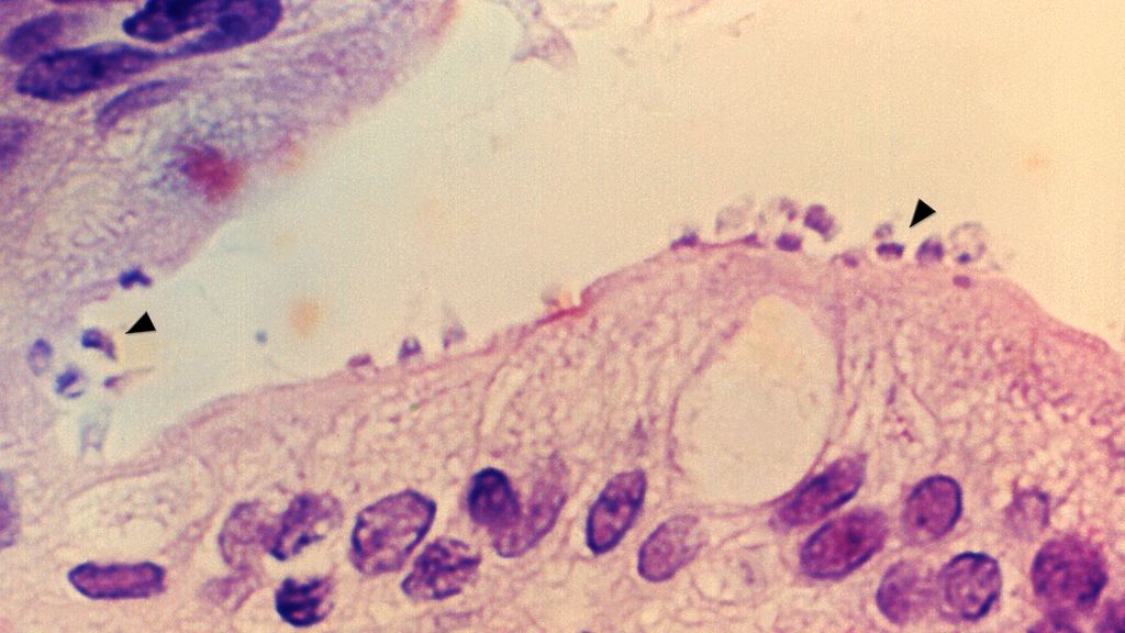 32 scary parasitic diseases | Live Science