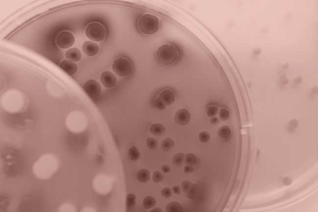 Scientists have found a secret 'switch' that lets bacteria resist ...